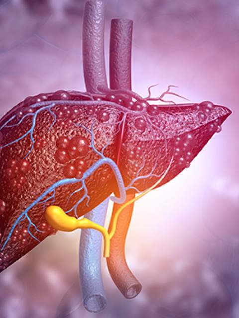 Estructura y función de las lipoproteínas | medPoint