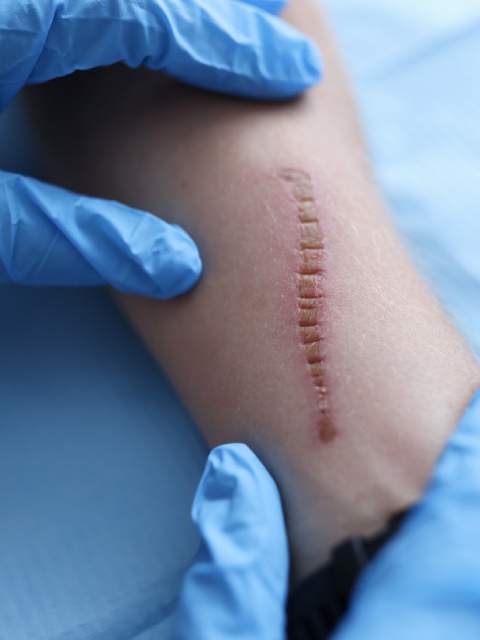 Manejo actual del dolor postoperatorio: Revisión actualizada | medPoint