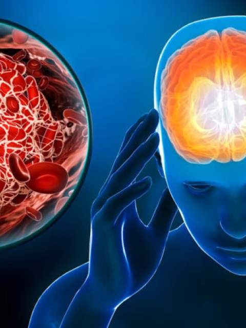 Guía de cuidados post-EVC para pacientes, cuidadores y familiares ...