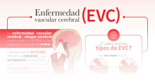Enfermedad Vascular Cerebral (EVC) | medPoint