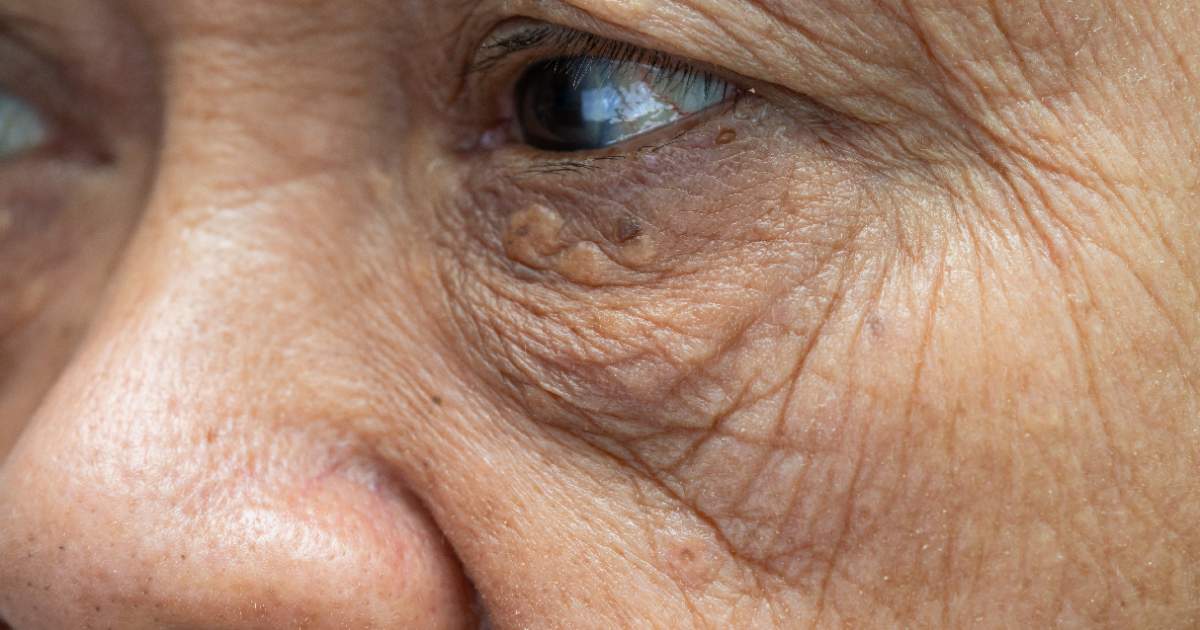Cambios psicológicos en el envejecimiento | medPoint